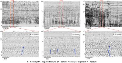 Frontiers | Automated Analysis Using a Bayesian Functional Mixed-Effects Model With Gaussian ...